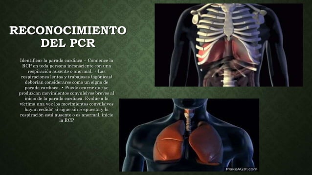 RCP - Básico. Reanimación Cardiopulmonar Básica | PPT