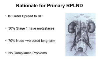 ECCLU 2011 - N. Clarke - Testicular cancer - Role of surgery in the ...