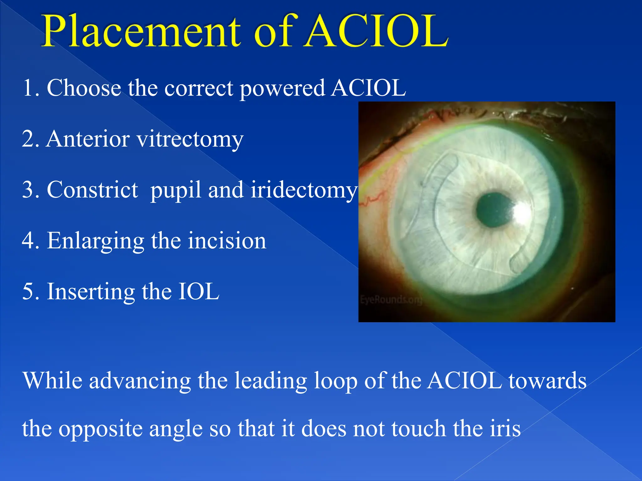 PCR management presentation of pcrPPT.pptx