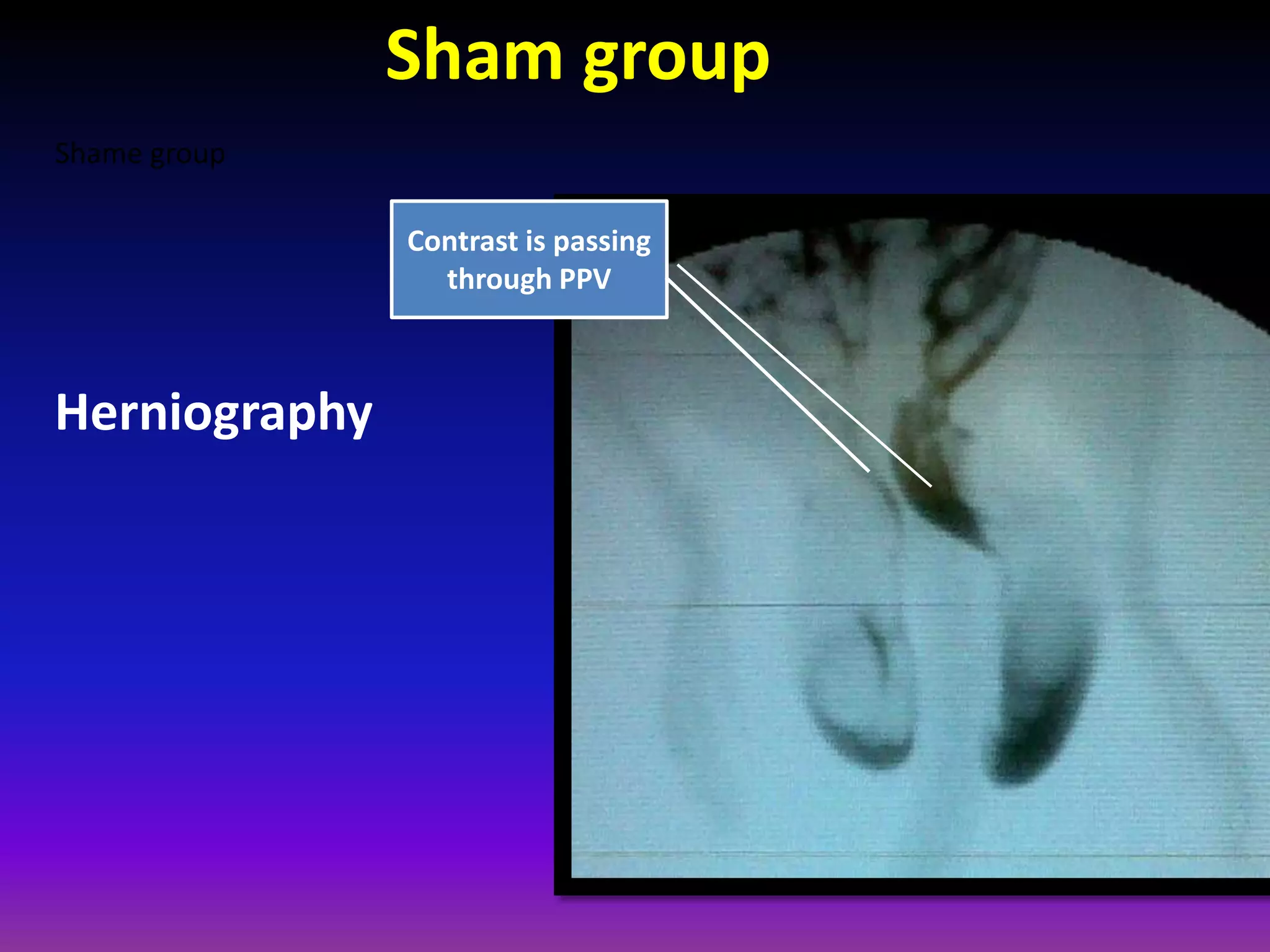 Percutaneous Oblitration ofpatent process vaginalis : a rat model for ...