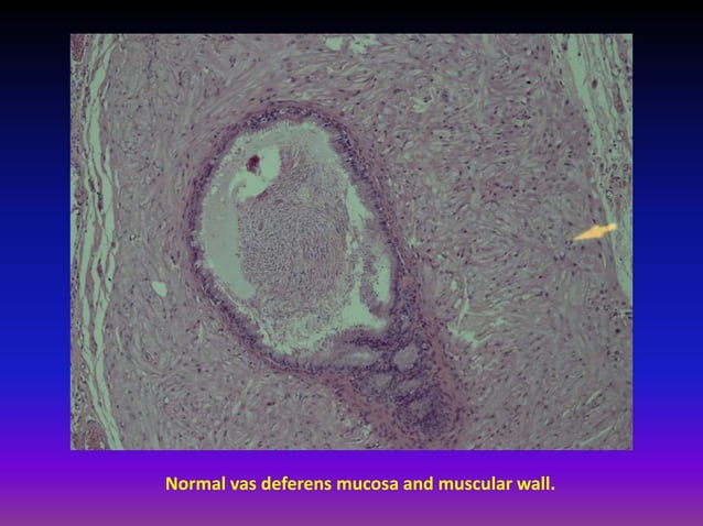 Percutaneous Oblitration ofpatent process vaginalis : a rat model for ...