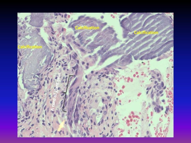 Percutaneous Oblitration ofpatent process vaginalis : a rat model for ...