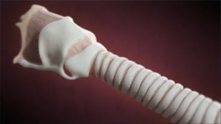 PARTIAL CRICOTRACHEAL RESECTION AND ITAS MANAGEMENT | PPTX