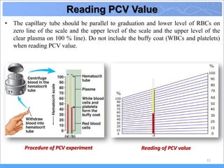 PCV.pdf