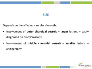 Polypoidal choroidal vasculopathy | PPTX