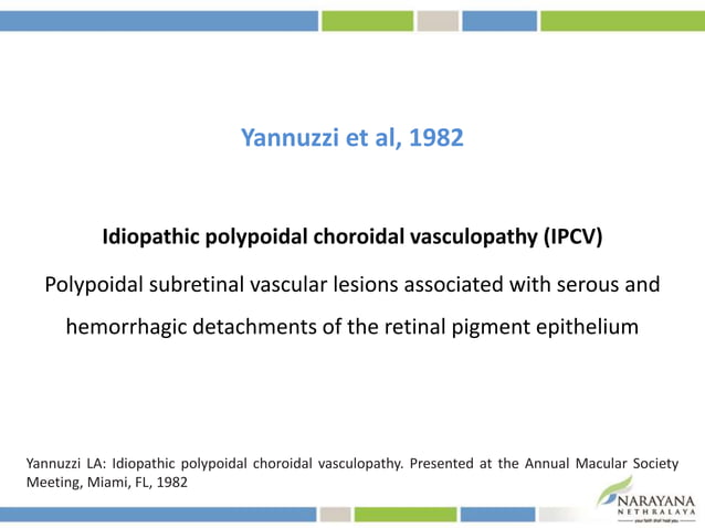Polypoidal choroidal vasculopathy | PPTX | Eye and Vision Conditions ...