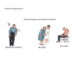 PARKINSON’S DISEASE | PPTX