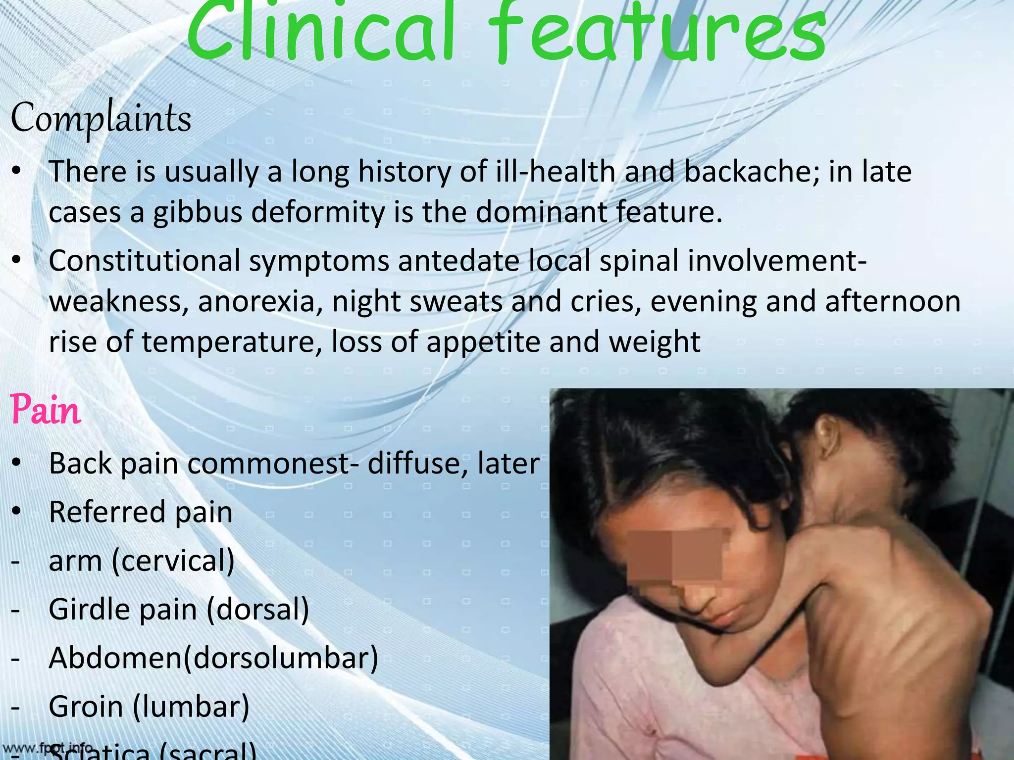 Pott's disease- tuberculosis of the spine | PPTX