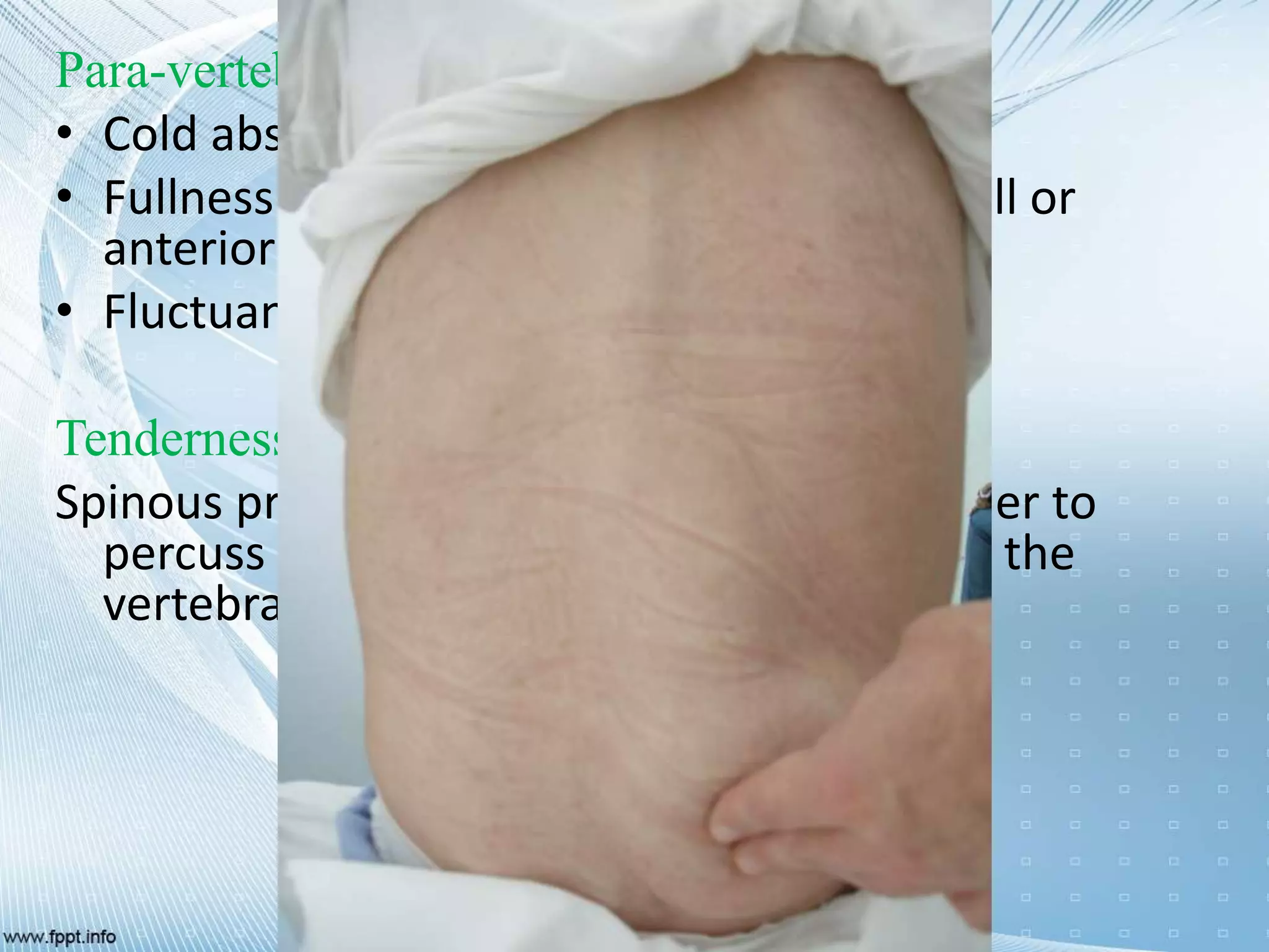 Pott's disease- tuberculosis of the spine | PPTX