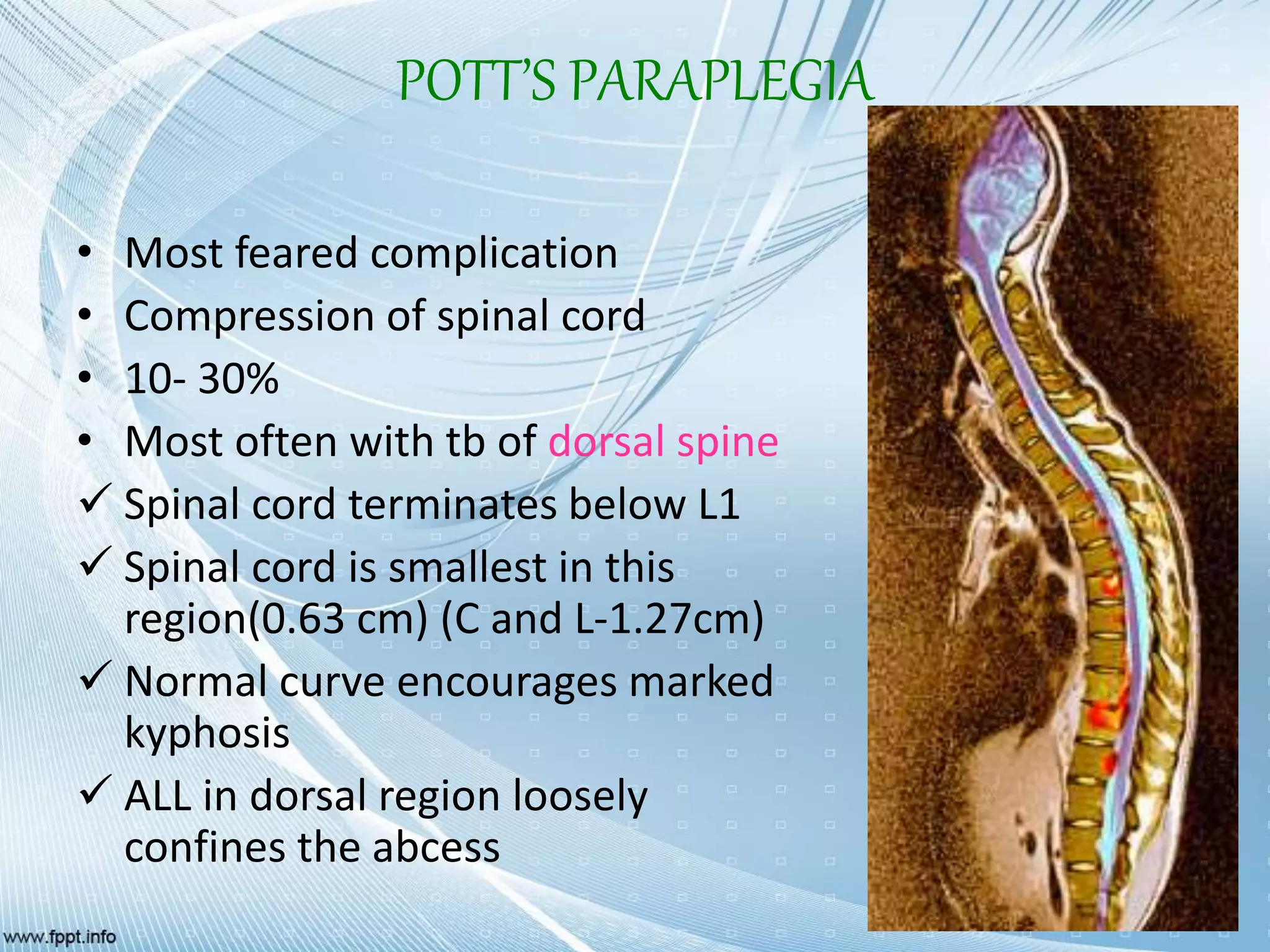 Pott's disease- tuberculosis of the spine | PPTX