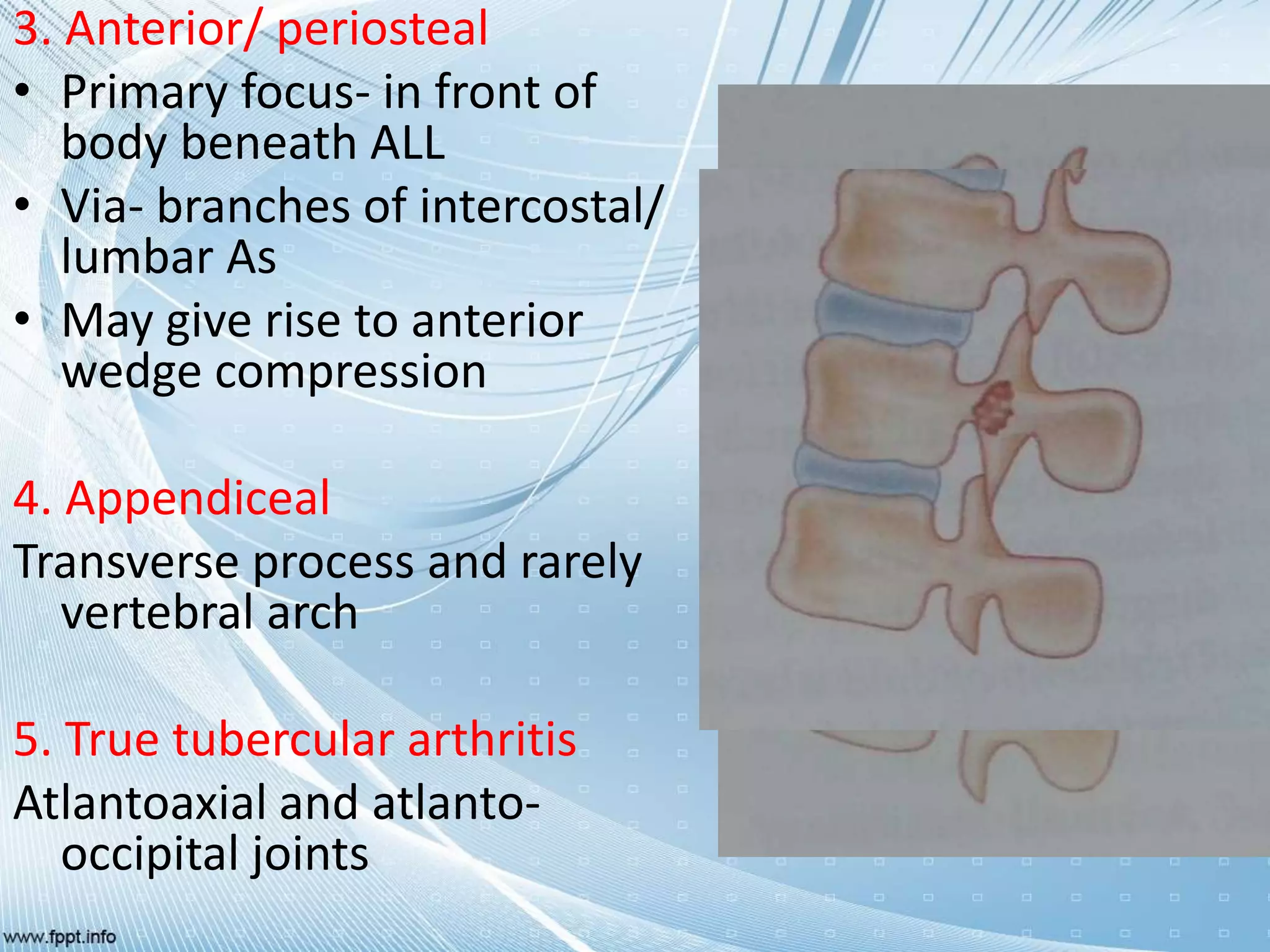Pott's disease- tuberculosis of the spine | PPTX