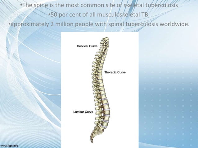 Pott's disease- tuberculosis of the spine | PPTX