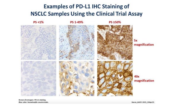 PD-L1 testing | PPTX | Cancer | Diseases and Conditions