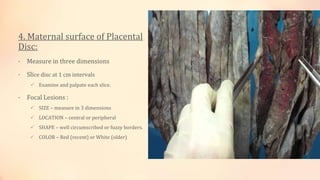 Placenta | PPTX