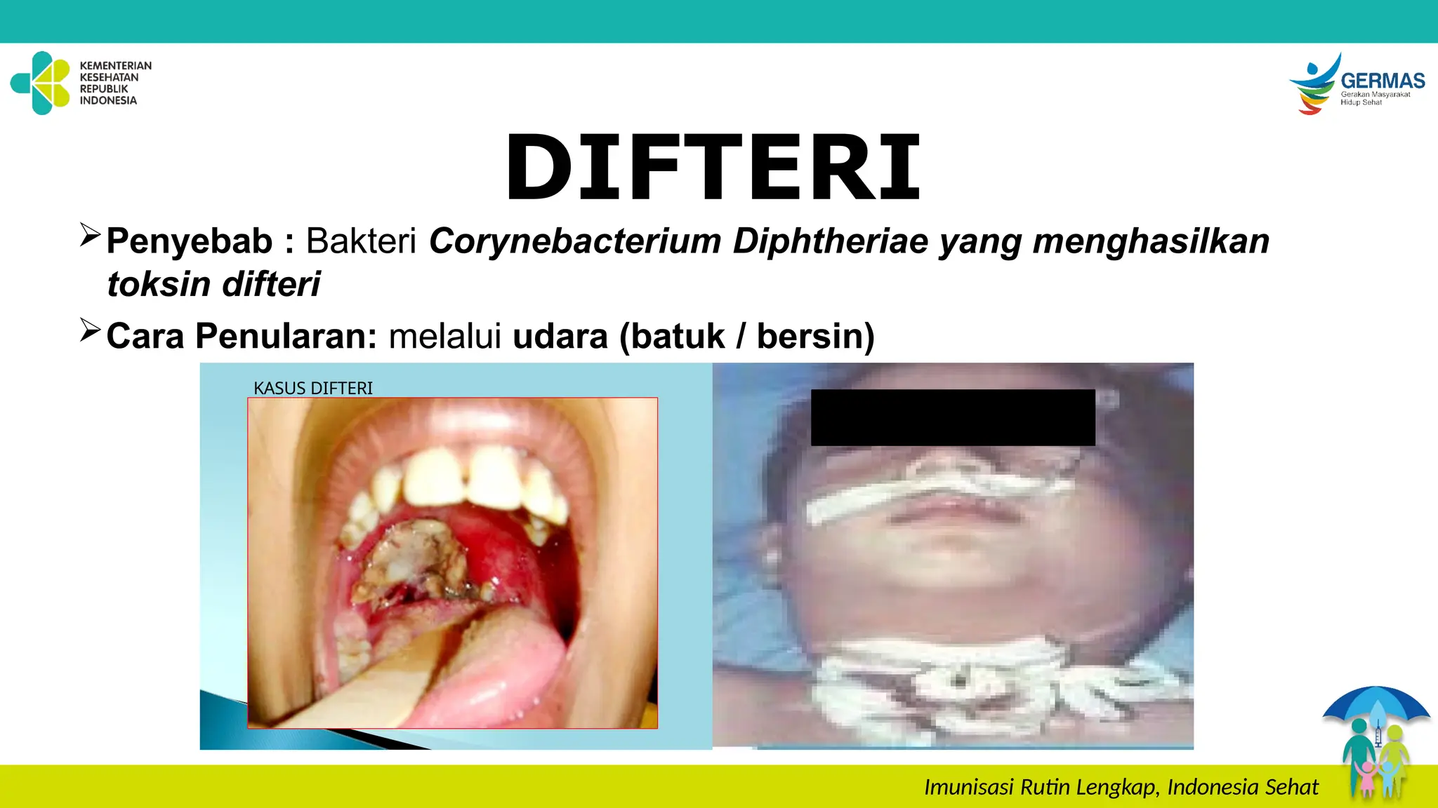 Pressentasi PD3I Bukittinggi 2024 .pptx