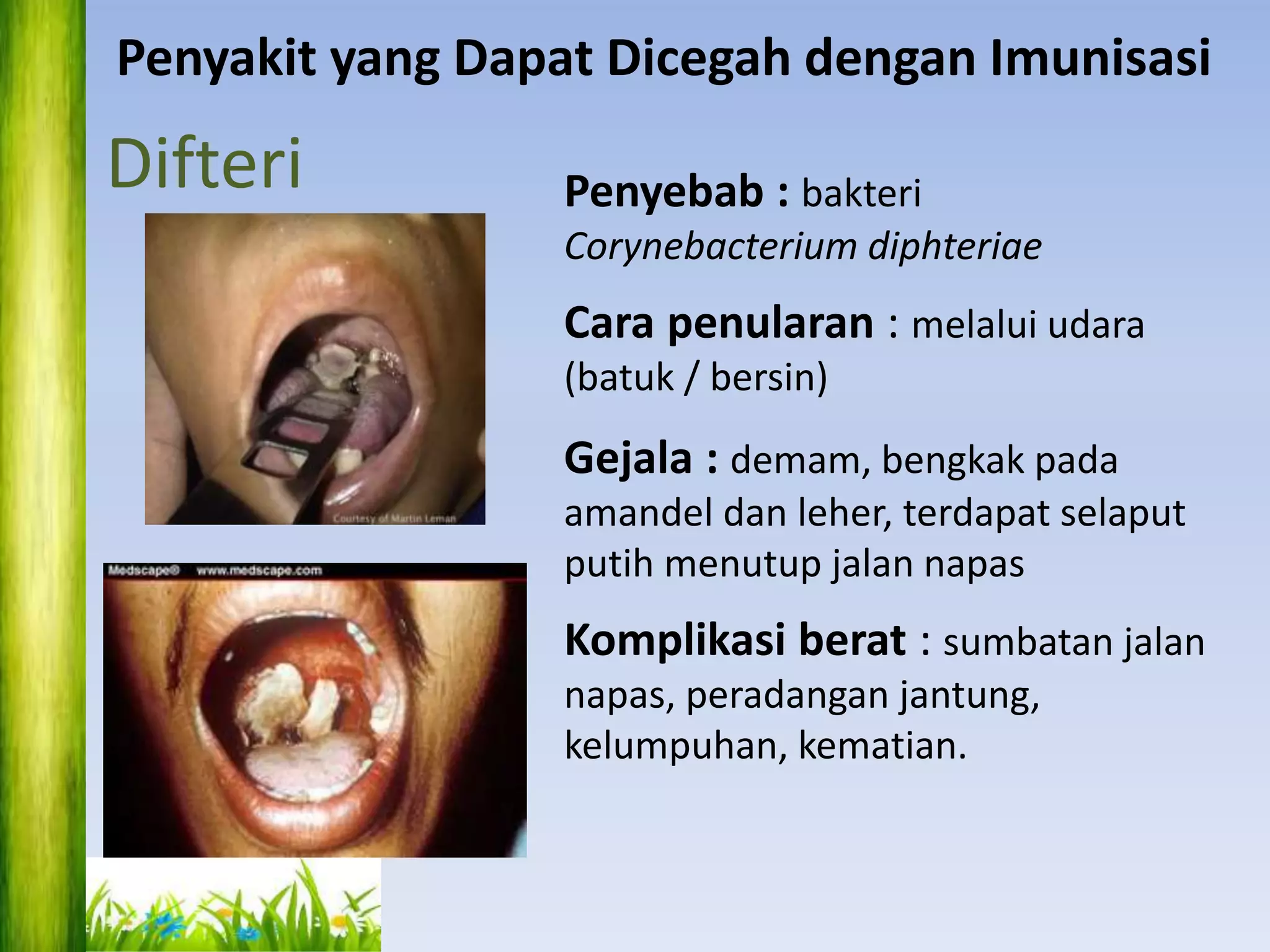 PD3I Nusantara Sehat | PPT