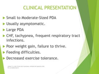 patent ductus arteriosis ppt | PPTX