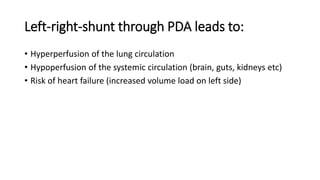 Patent Ductus Arteriosus - management in preterm infants | PPTX