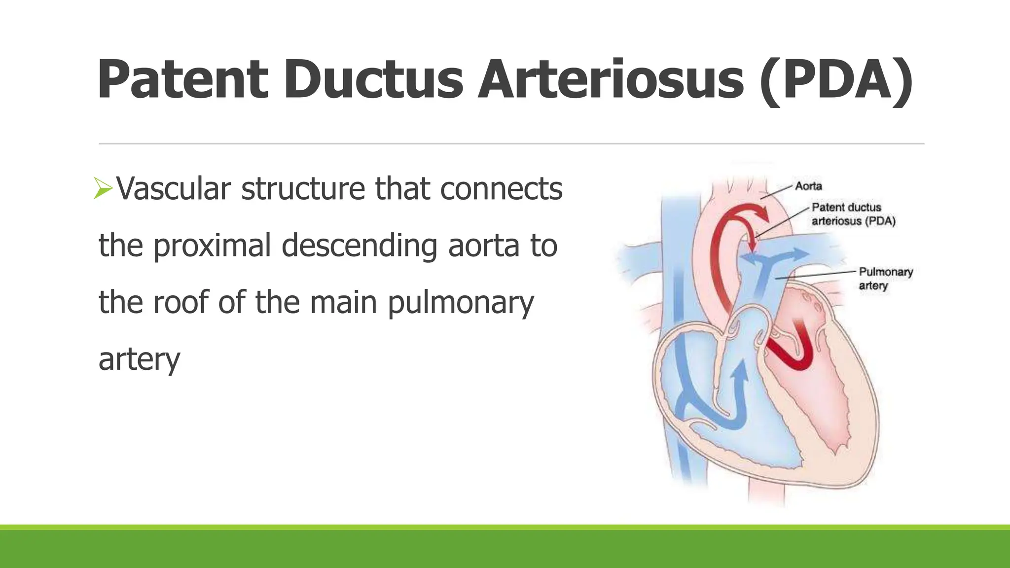 Imaging Findings of Patent Ductus Arteriosus.pptx