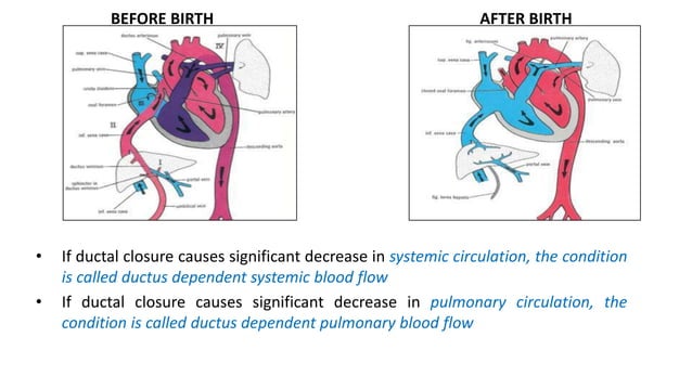 Ductus dependent circulation