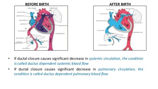 Ductus dependent circulation