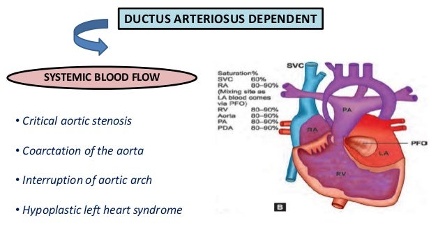 Ductus dependent circulation