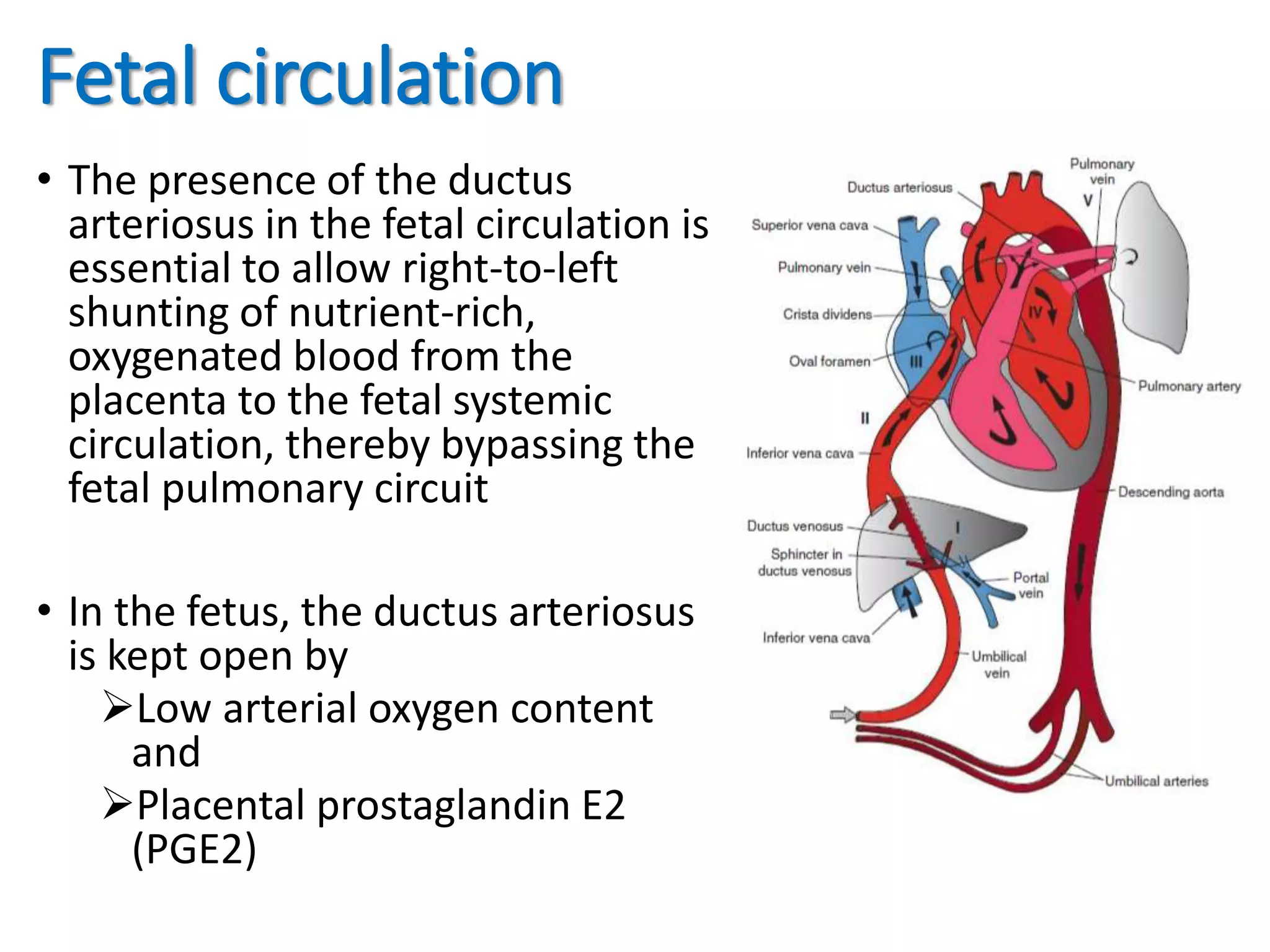 Patent Ductus Arteriosus (PDA) | PPTX