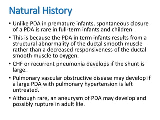 Patent Ductus Arteriosus (PDA) | PPTX