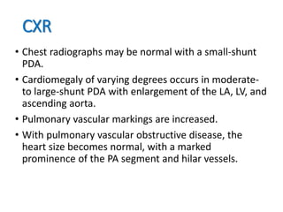 Patent Ductus Arteriosus (PDA) | PPTX