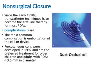 Patent Ductus Arteriosus (PDA) | PPTX