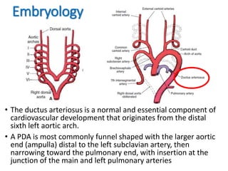 Patent Ductus Arteriosus (PDA) | PPTX