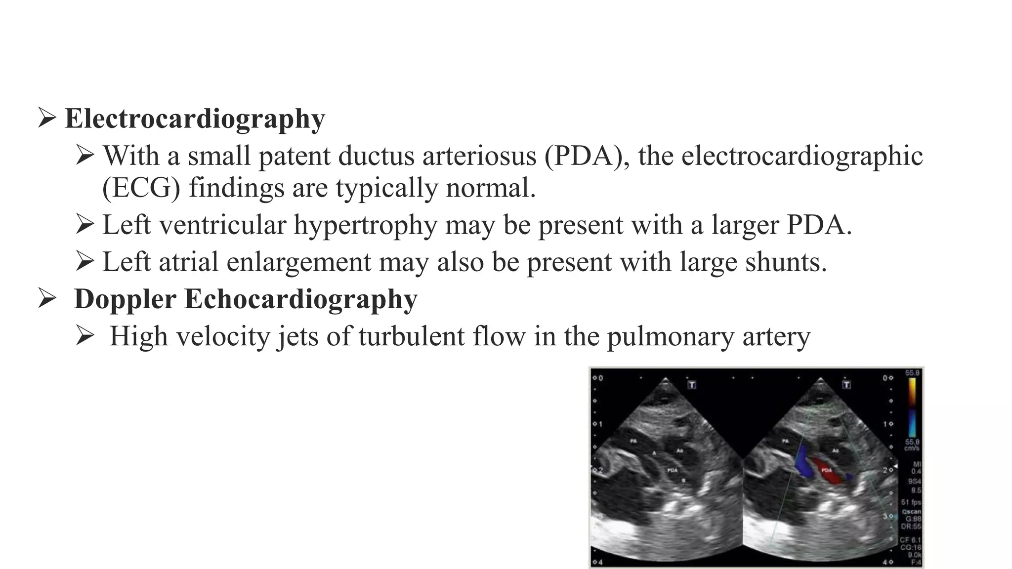 PDA,AP WINDOW, TA.pptx