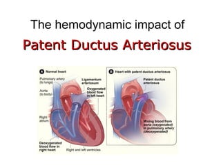 Pda Part 3 Anatomy Physiology | PPT