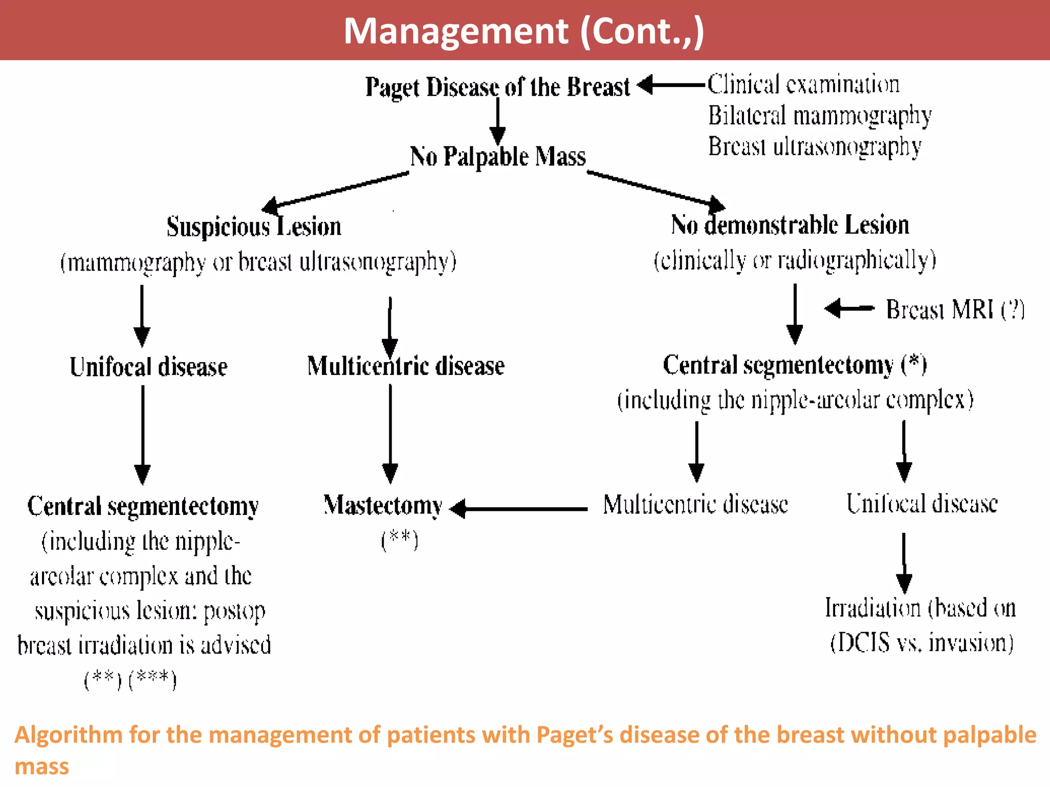 Paget’s Disease of Breast (PDB) | PPTX