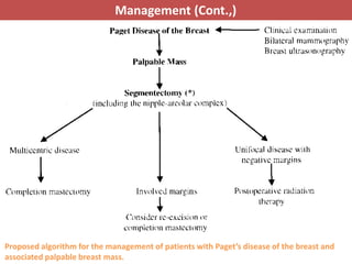Paget’s Disease of Breast (PDB) | PPTX