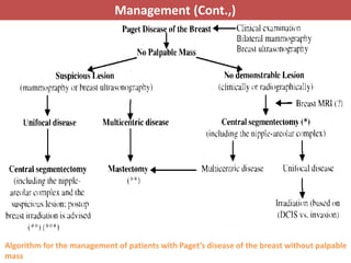Paget’s Disease of Breast (PDB) | PPTX