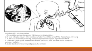 Pulmonary drug delivery system. | PPTX