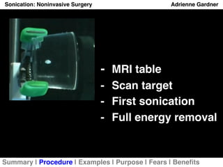 Sonication: Noninvasive Surgery | PDF | Surgery | Medical Health