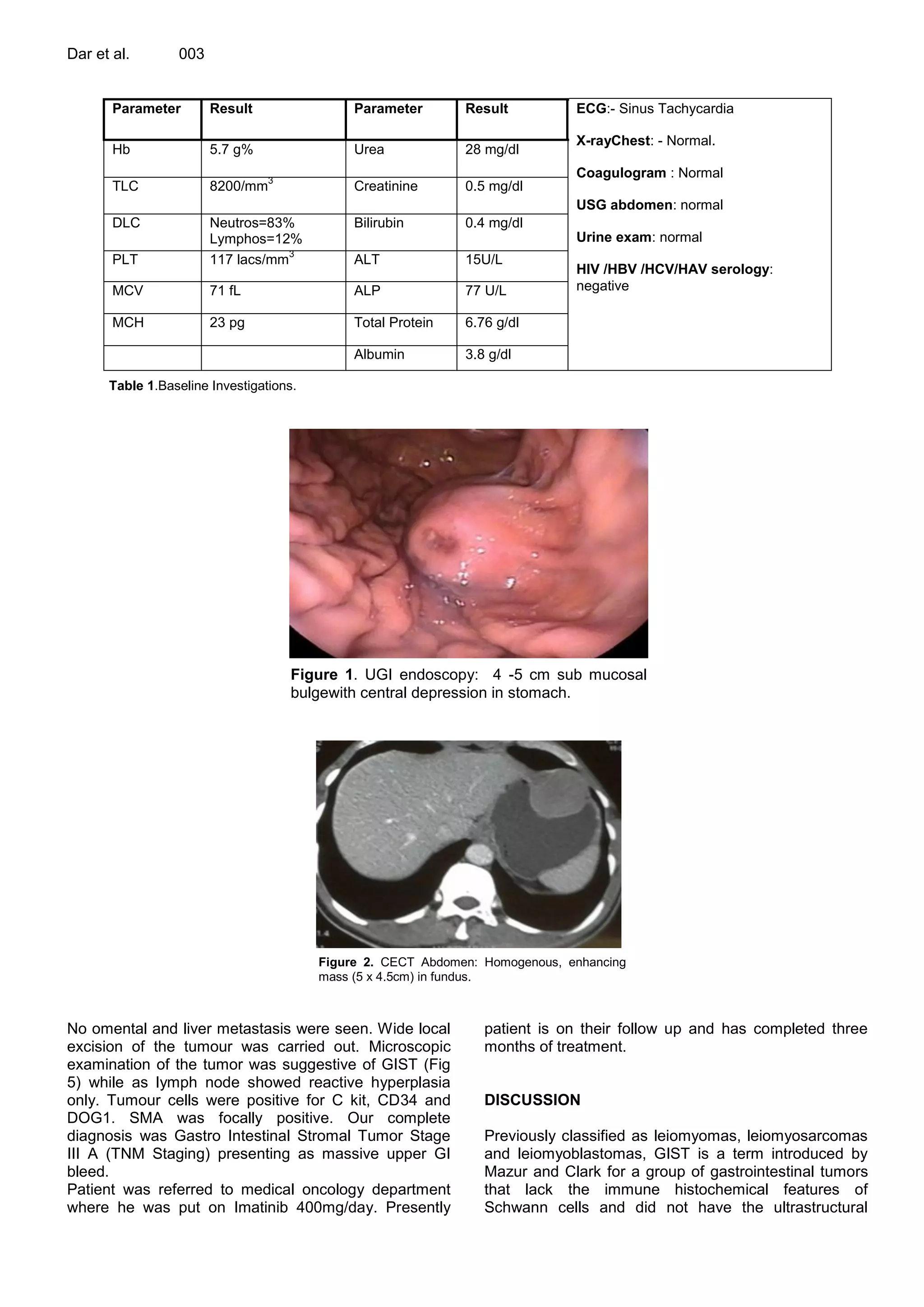 A rare cause of upper GI bleed | PDF