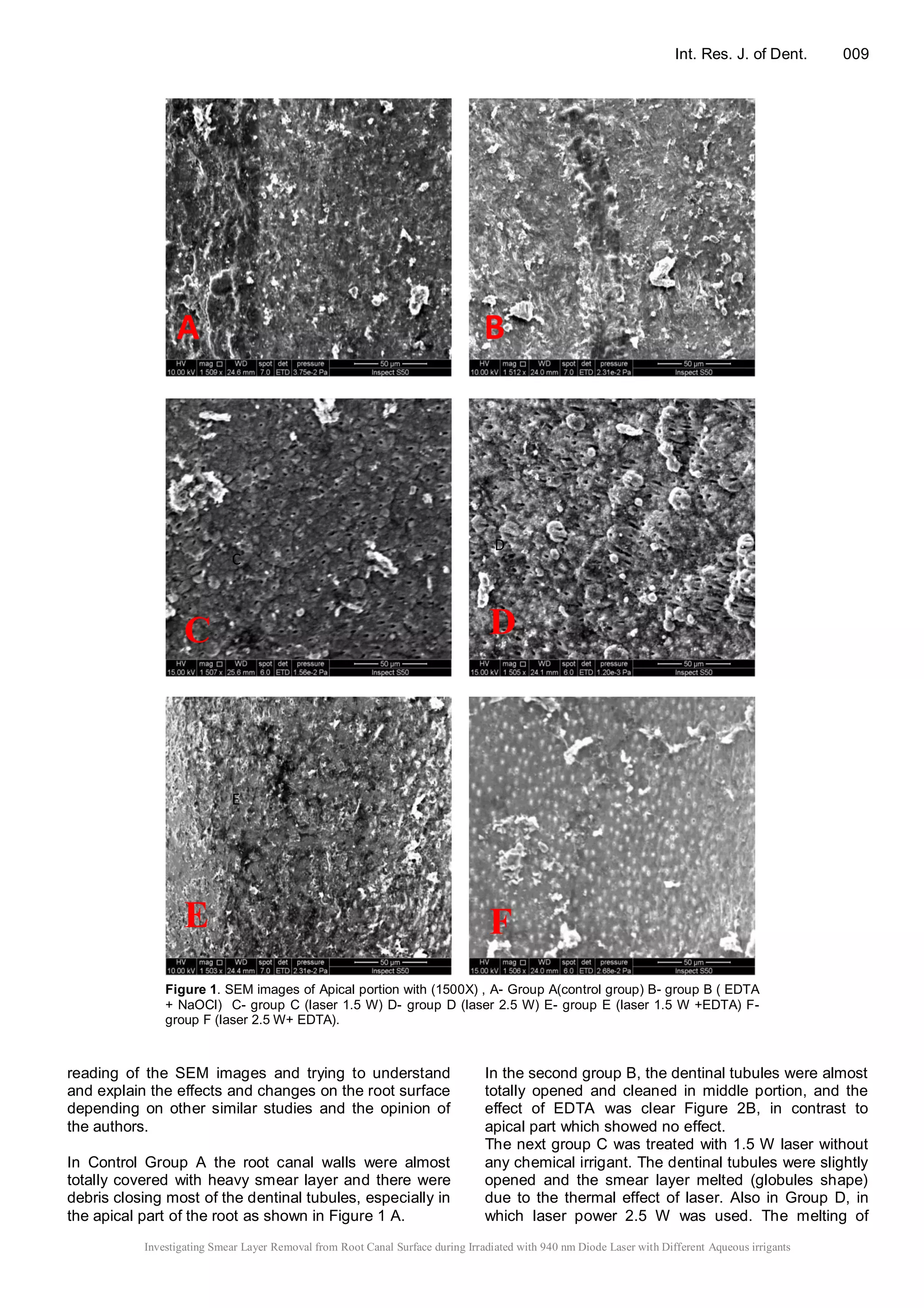 Investigating smear layer removal from root canal surface during ...