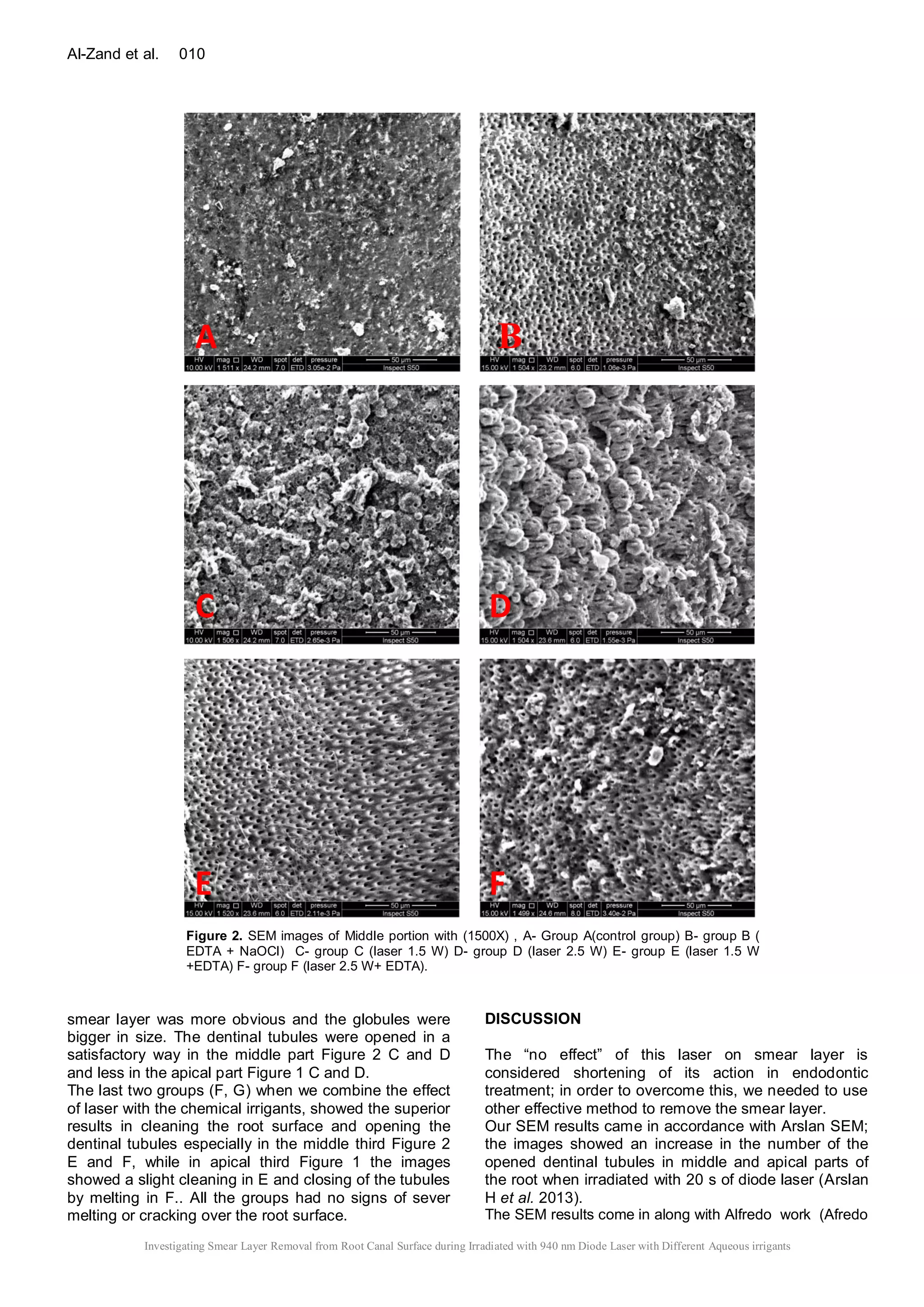 Investigating smear layer removal from root canal surface during ...