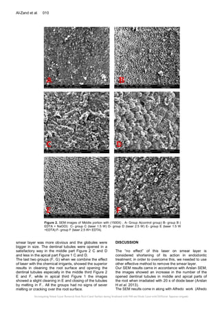 Investigating smear layer removal from root canal surface during ...