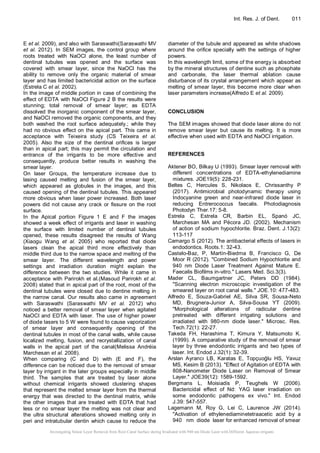 Investigating smear layer removal from root canal surface during ...