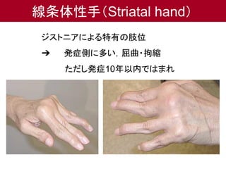 パーキンソン症候の診断 | PPT