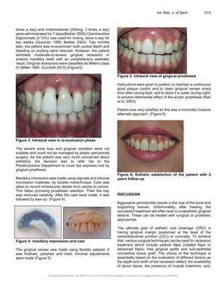 Gingival prosthesis: an efficient solution to severe gingival ...
