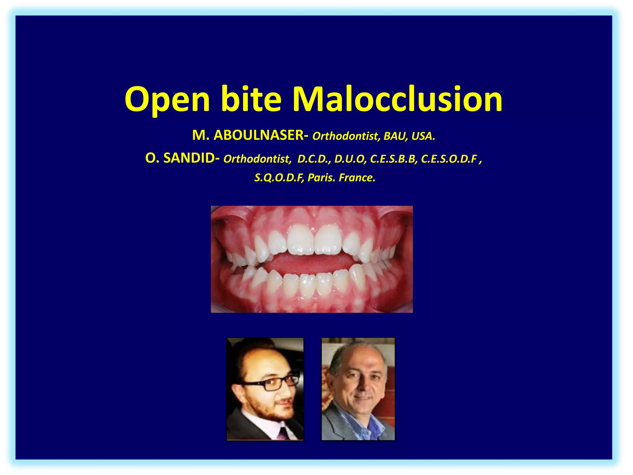 Pdf- open-bite-malocclusion | PDF