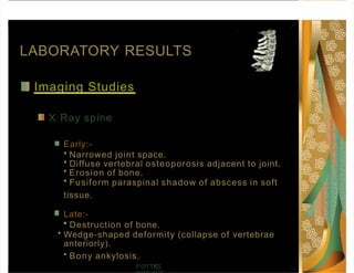 Pott disease TB vertebrae jvjgjgigiggigu | PPT