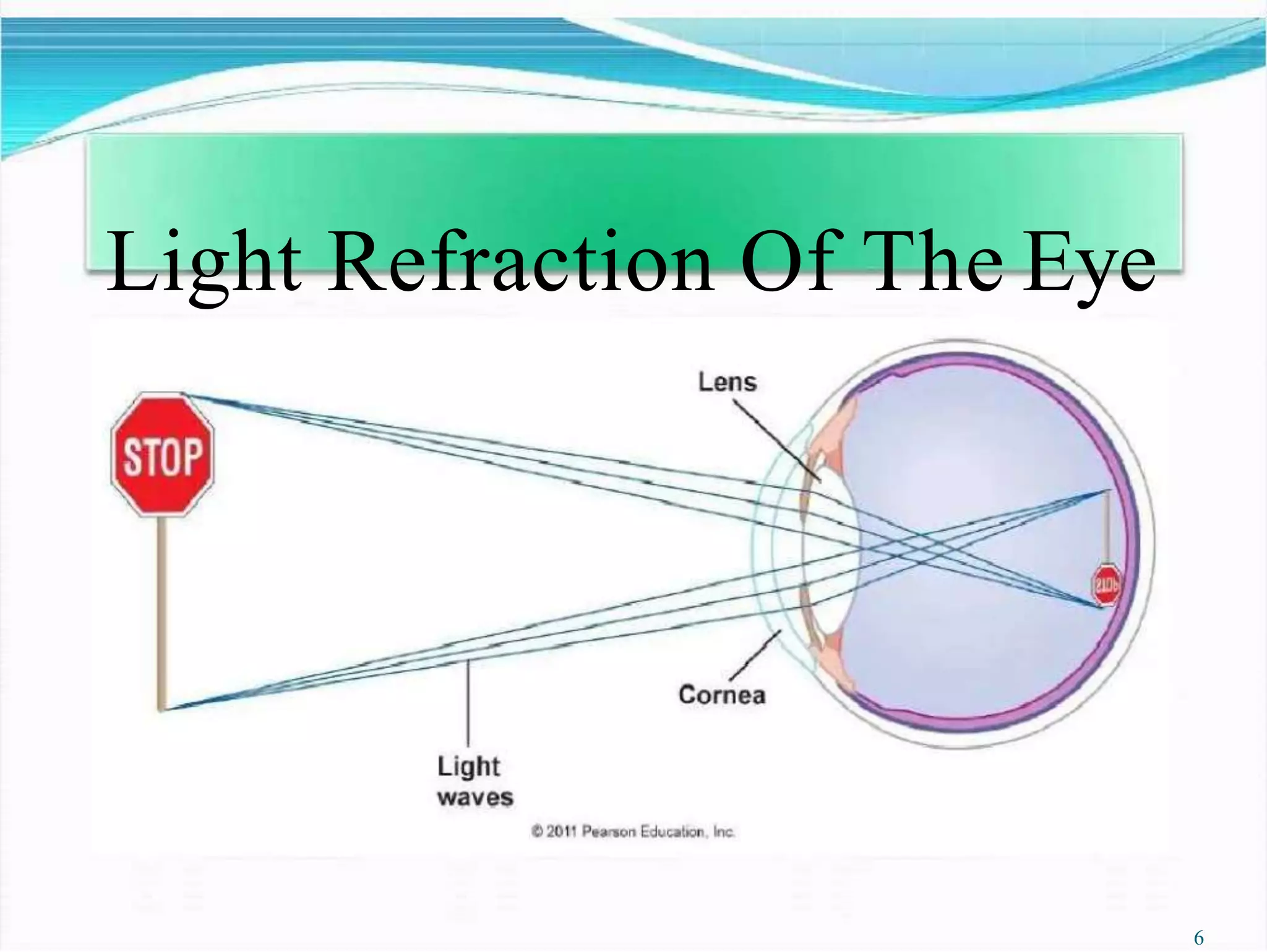 pdf-tbl-1-refractive-error-slides.pptx
