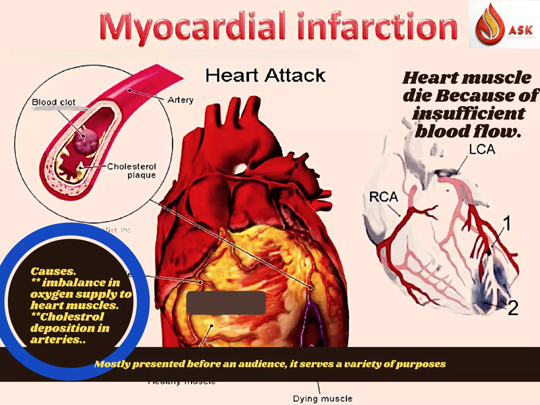 "Health issues related to Cardiovascular System" | PDF