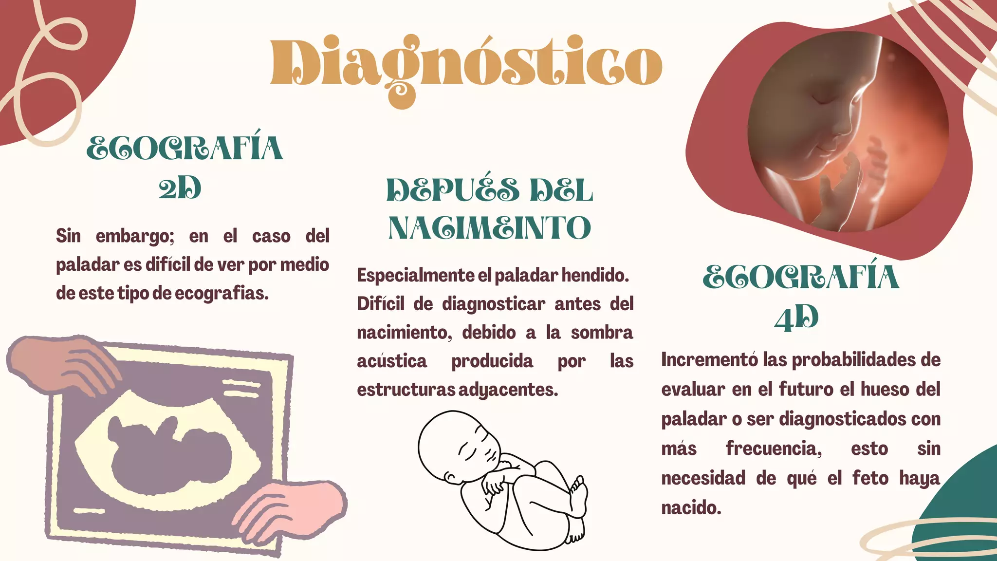 Labio y paladar hendido | PPT